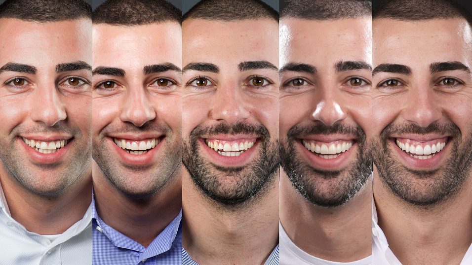 Smile-design - Dentalni Center dr. Kovačič